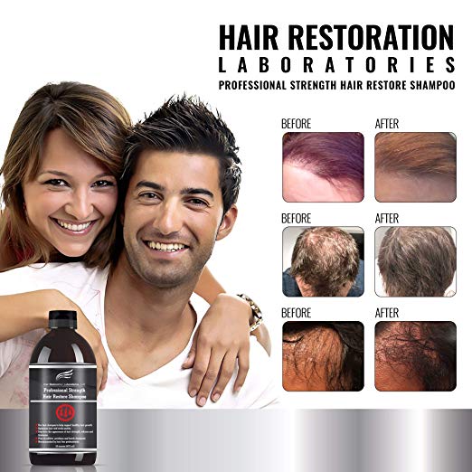 Hair Restoration Laboratories Professional Strength Hair Restore